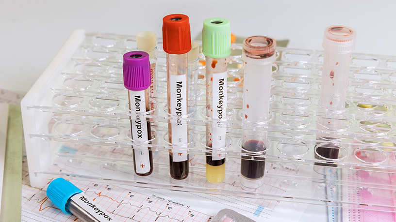 Monkeypox: The latest tool in the attacker’s arsenal | ITWeb